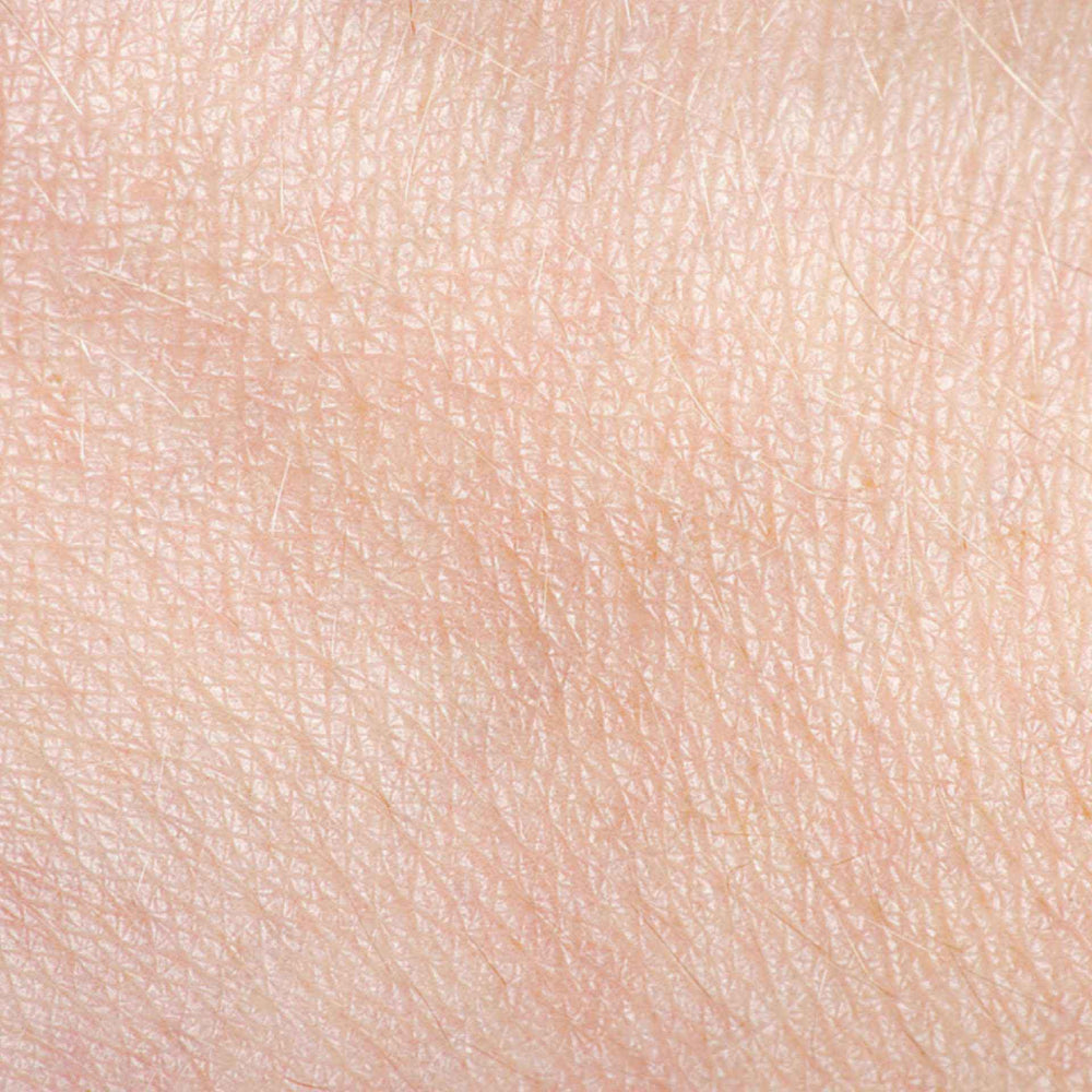 Skin types